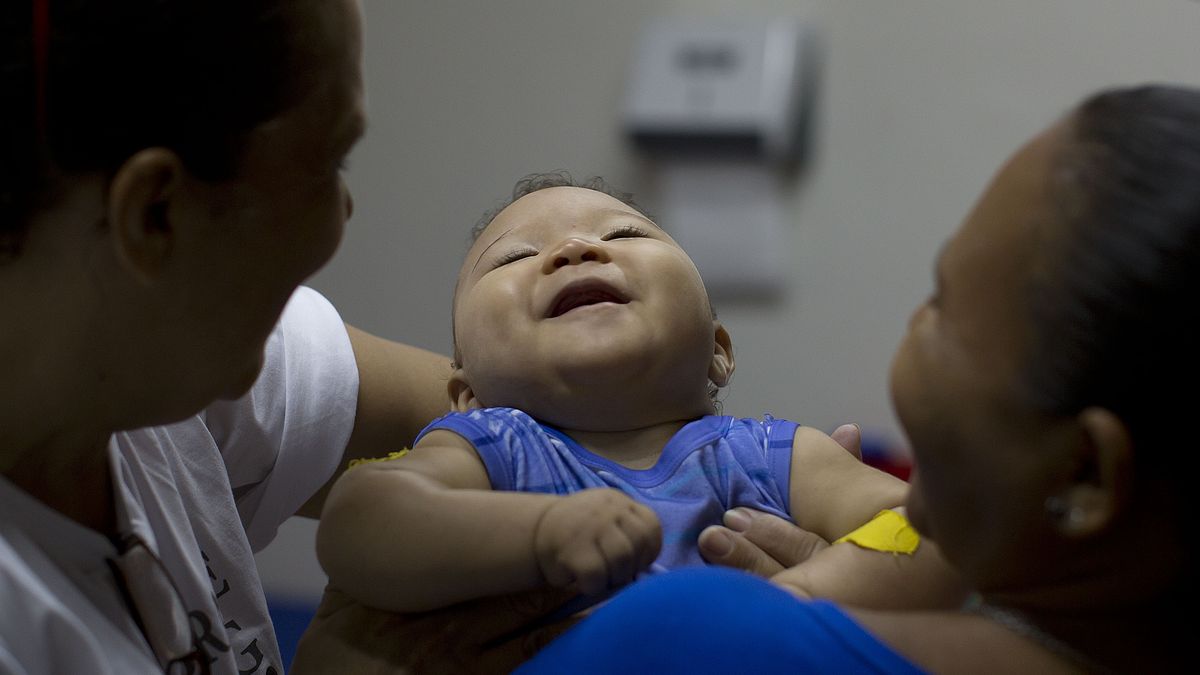 Brasil cambian criterio para determinar microcefalia